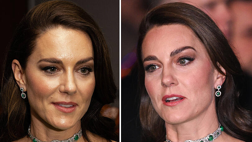 Was ist mit Prinzessin Kates Gesicht passiert? Jetzt spricht ein Beauty ...